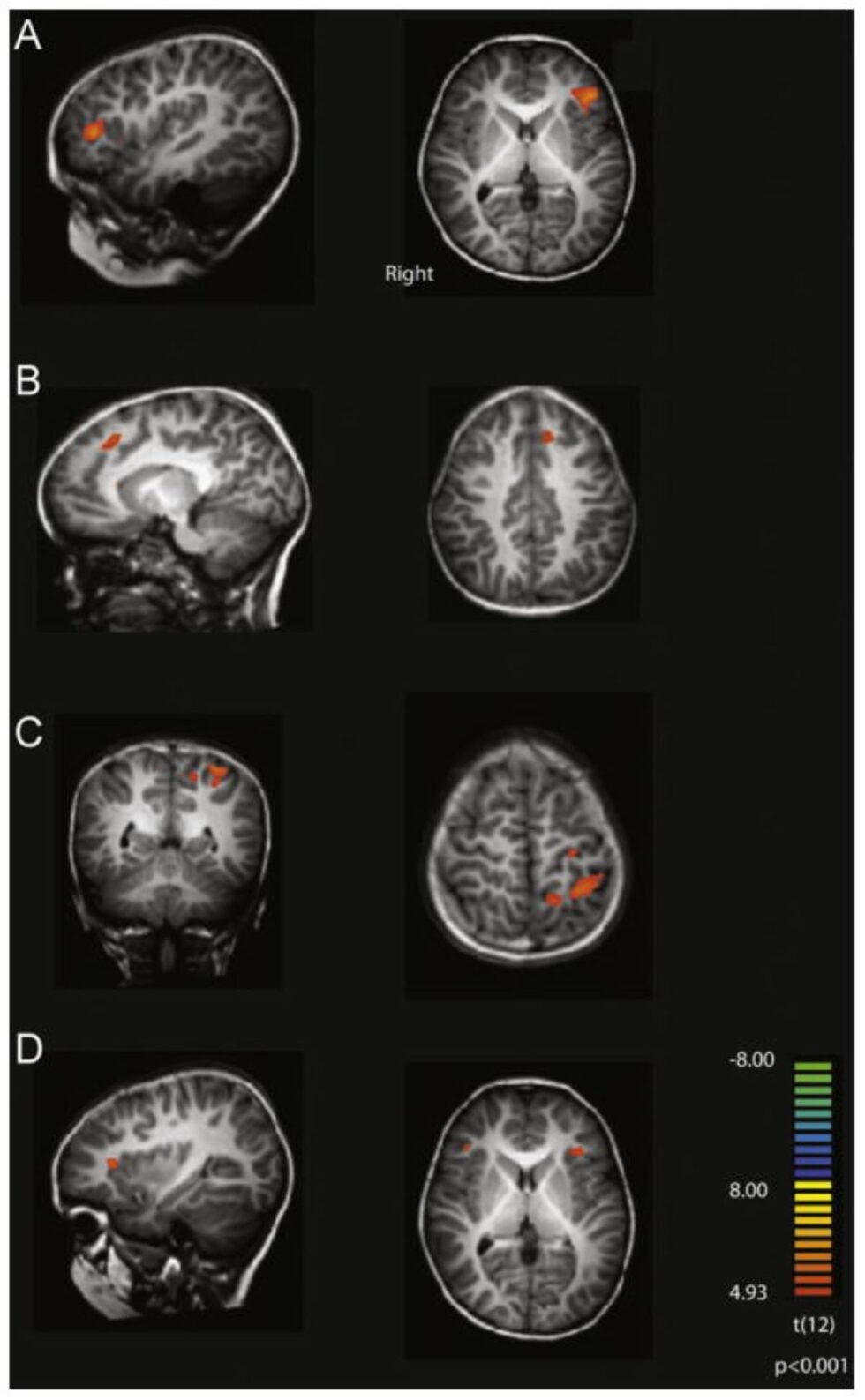 Handwriting & the brain's 'reading circuit' - a vital link! - Ricardo ...